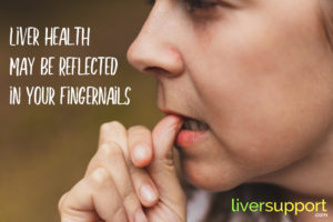Liver Health May Be Reflected in Your Fingernails | LiverSupport.com