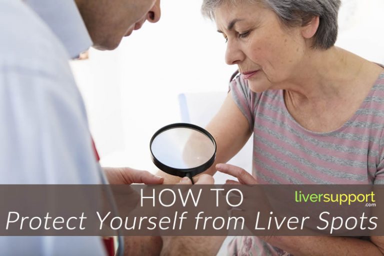 How to Prevent and Improve the Look of Liver Spots
