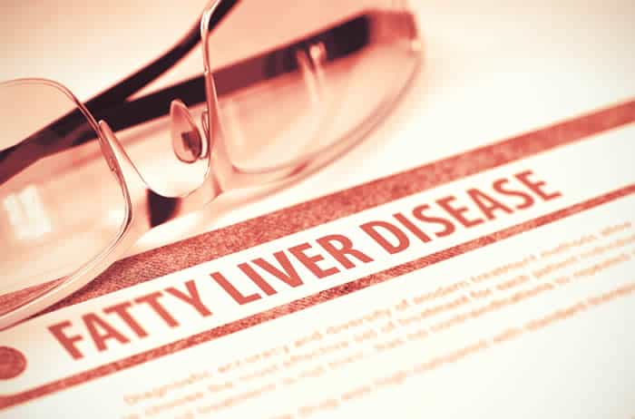 Fatty Liver Diease A New Mode Of Detection Www LiverSupport fatty-liver-diease-a-new-mode-of-detection-www-liversupport