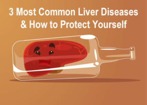 3 Common Liver Diseases + How to Protect Your Liver