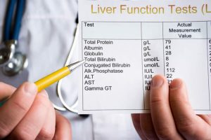 How to Check Liver Health at Home | LiverSupport.com